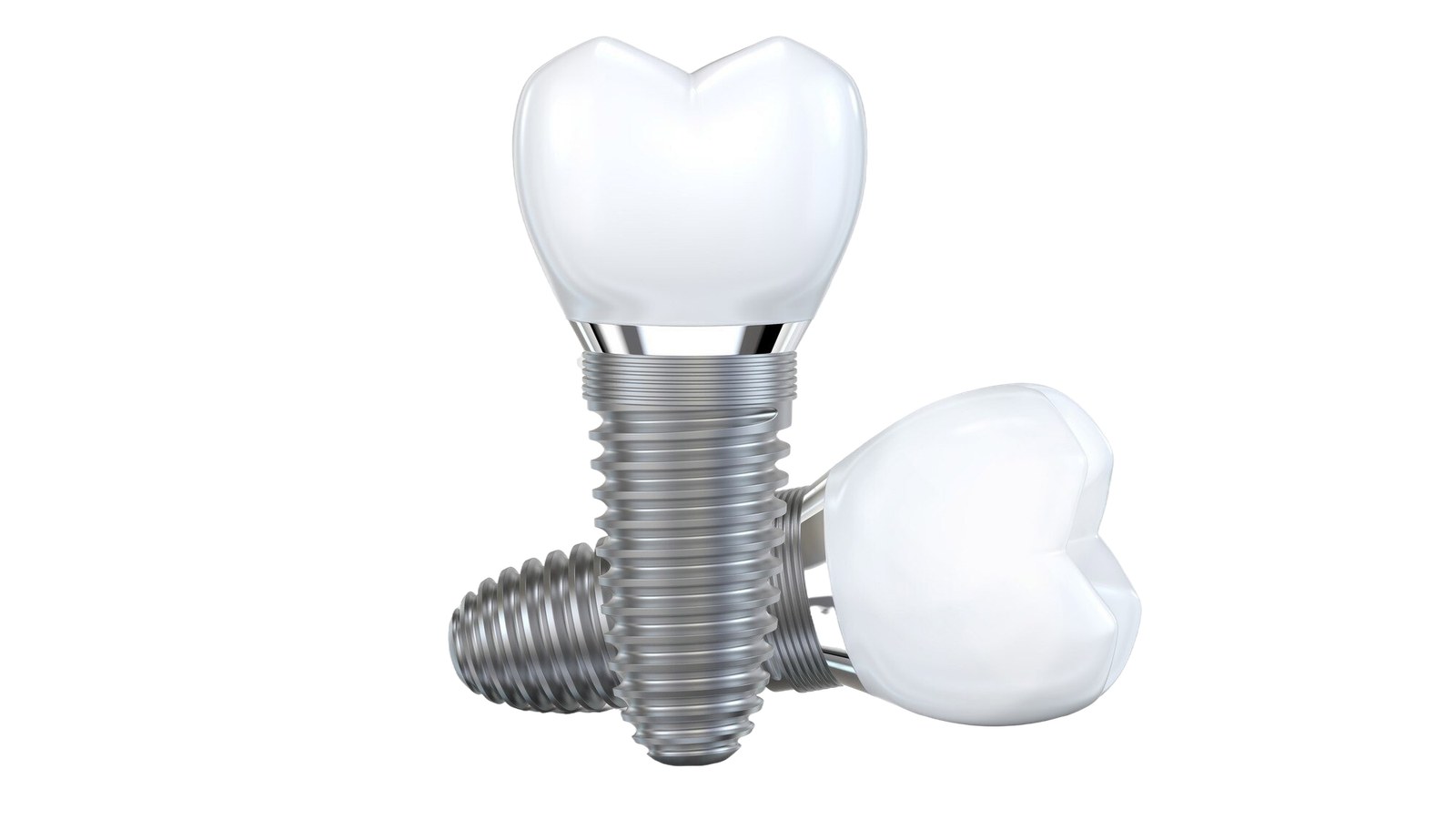 Dental Implant Landing - All Saints Dental Clinic